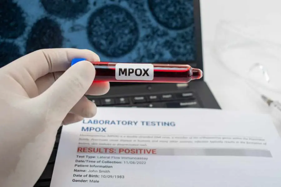 India reports first suspected Mpox case, patient under observation