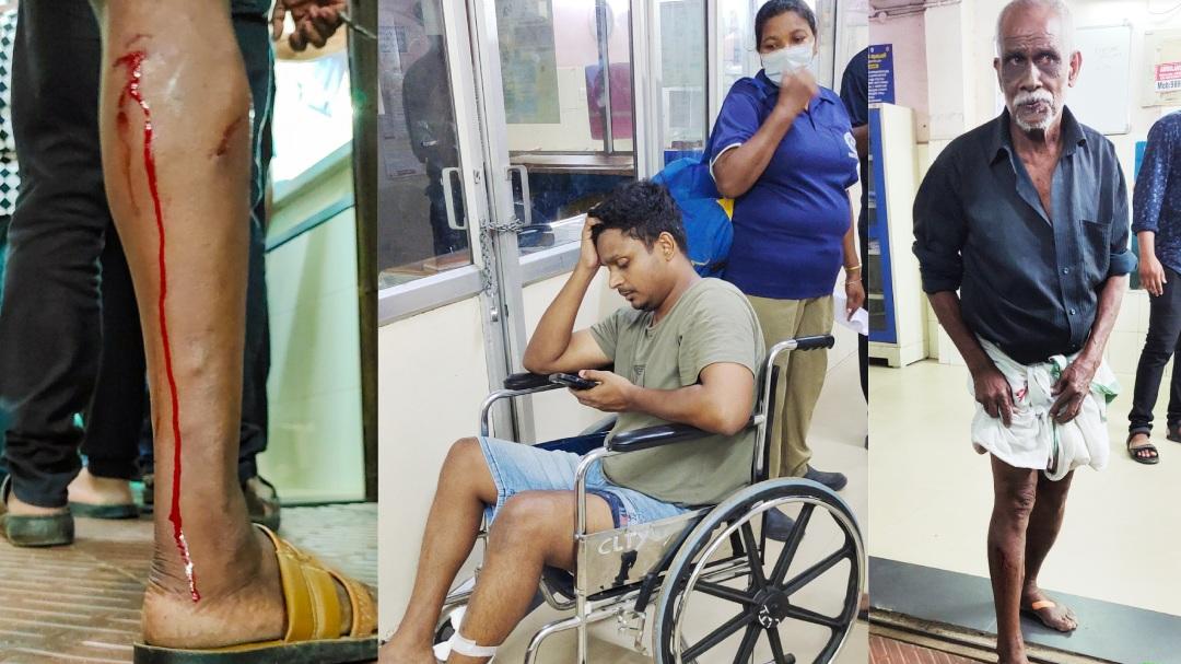 Stray dog bites 50 people in Thiruvananthapuram: Several seriously injured
