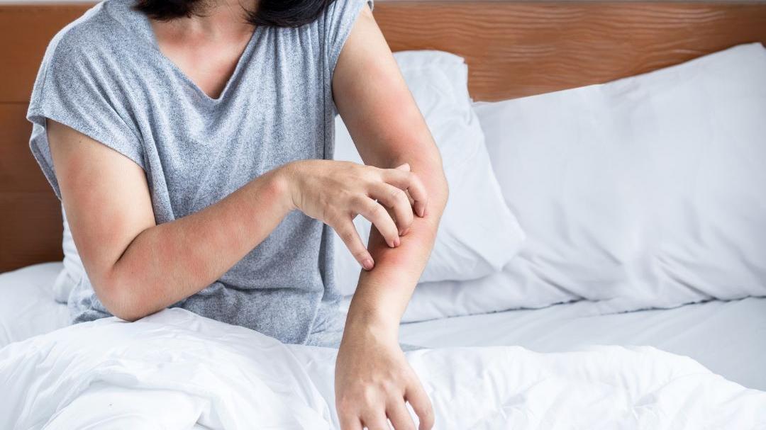 Physical exercise can trigger food allergies, here's how