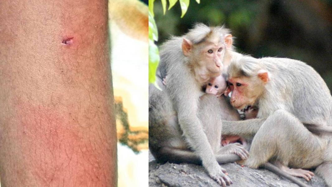Troop of monkeys attack four-year-old in TVM causing severe injuries