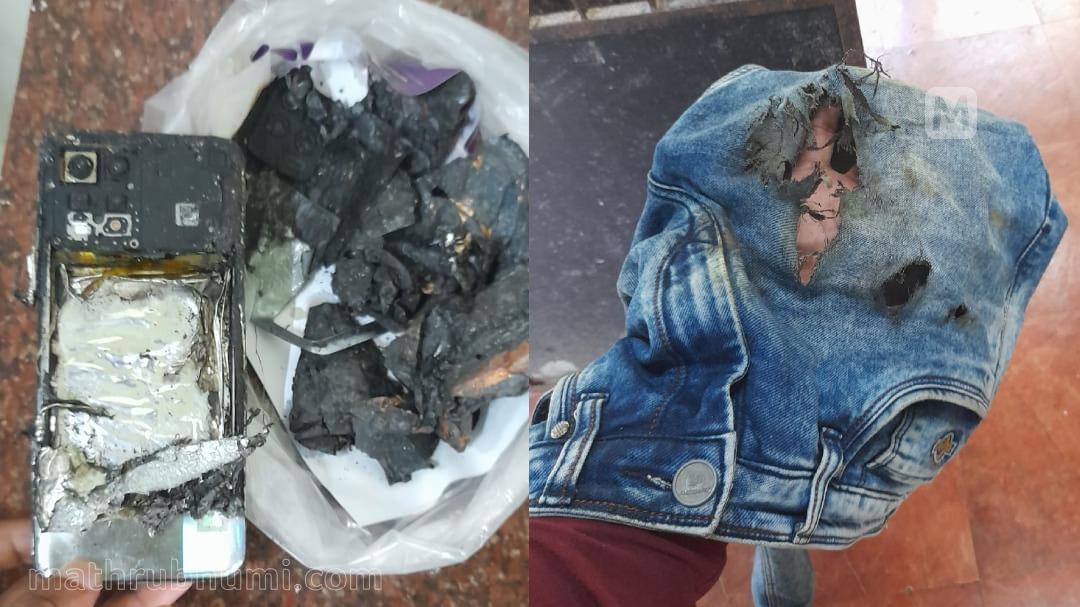 Kozhikode man suffers burn injuries after mobile phone explodes in his ...