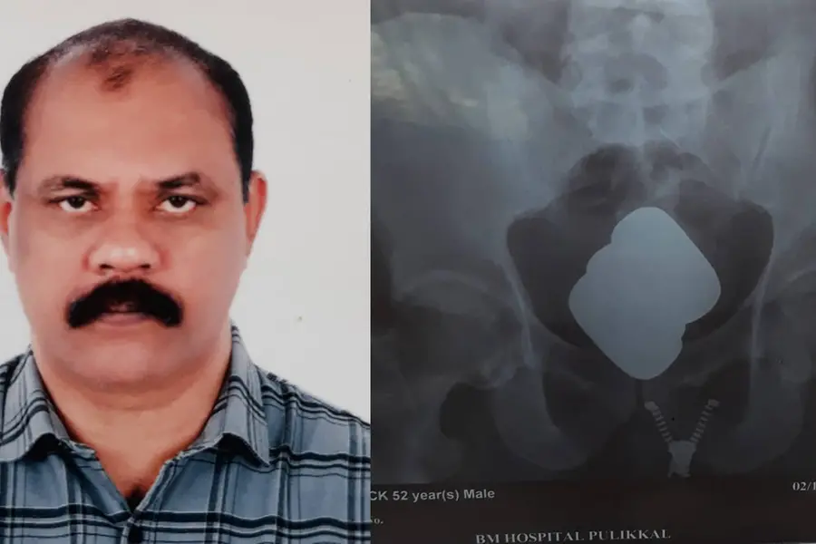 വയറ്റില്‍ സ്വര്‍ണമിശ്രിതത്തിന്റെ ക്യാപ്‌സൂള്‍; കരിപ്പൂരില് ...