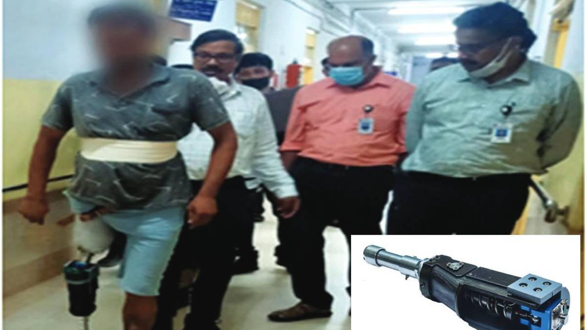 ISRO develops artificial leg fitted with microchip for amputees