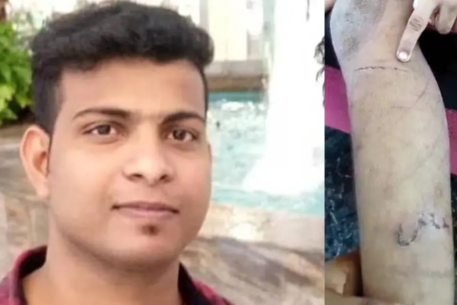 7 വയസ്സുകാരന്റെ ജനനേന്ദ്രിയത്തിലും വയറ്റിലും പൊള്ളിച്ചു,ശരീരത്തിലെങ്ങും ...