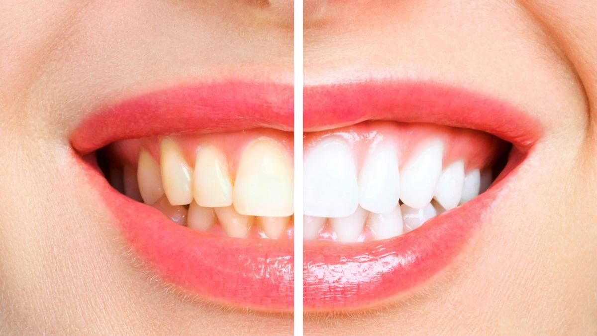The truth behind whitening toothpaste: Does it brighten your smile or ...