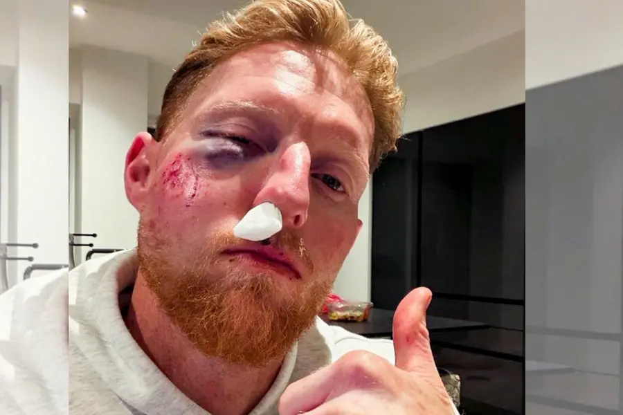 Nasty blow on the face - Stokes suffers injury after being struck by ...